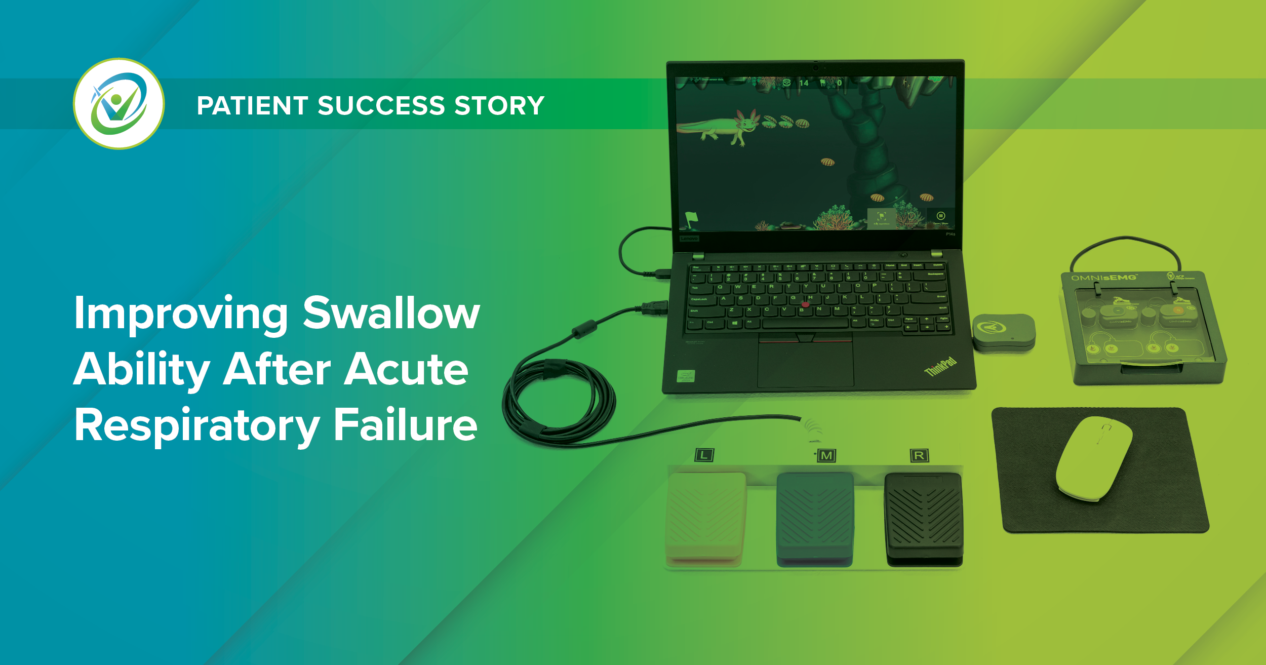 Improving Swallow Ability After Acute Respiratory Failure | ACPlus